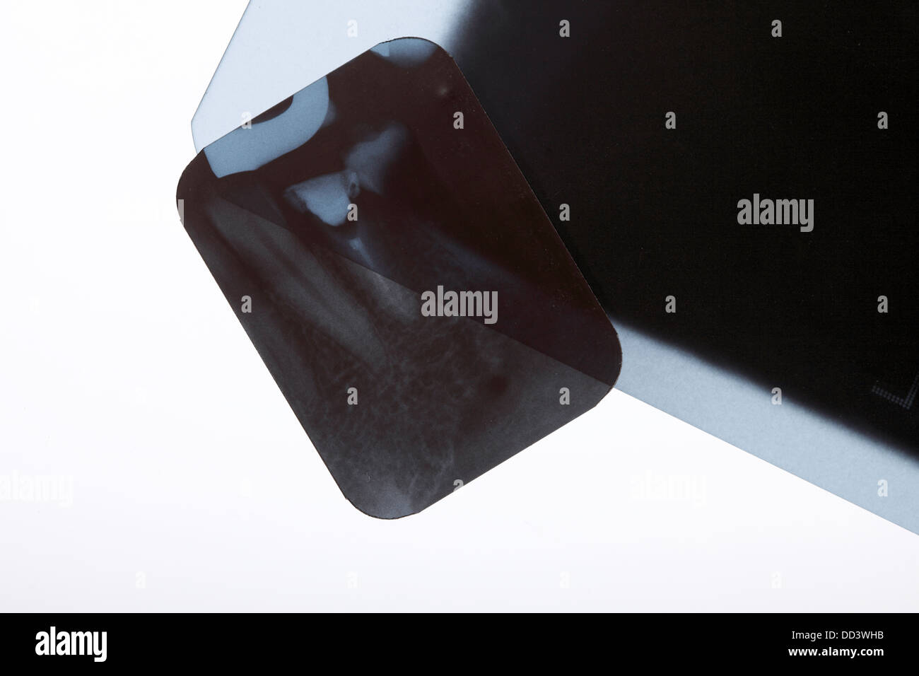 a dental x-ray film detail isolated on white Stock Photo - Alamy