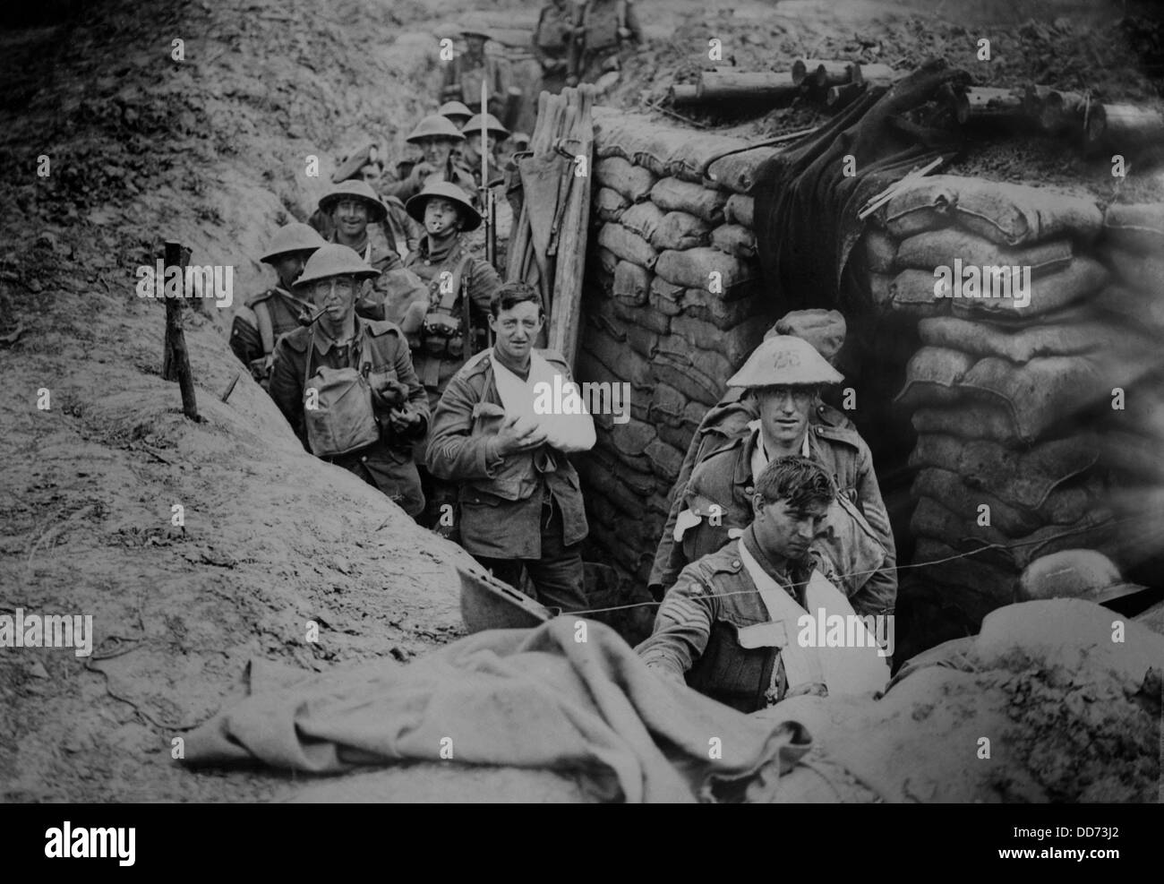 Bandaged British World War 1 soldiers in a battlefield trench, 1915 ...