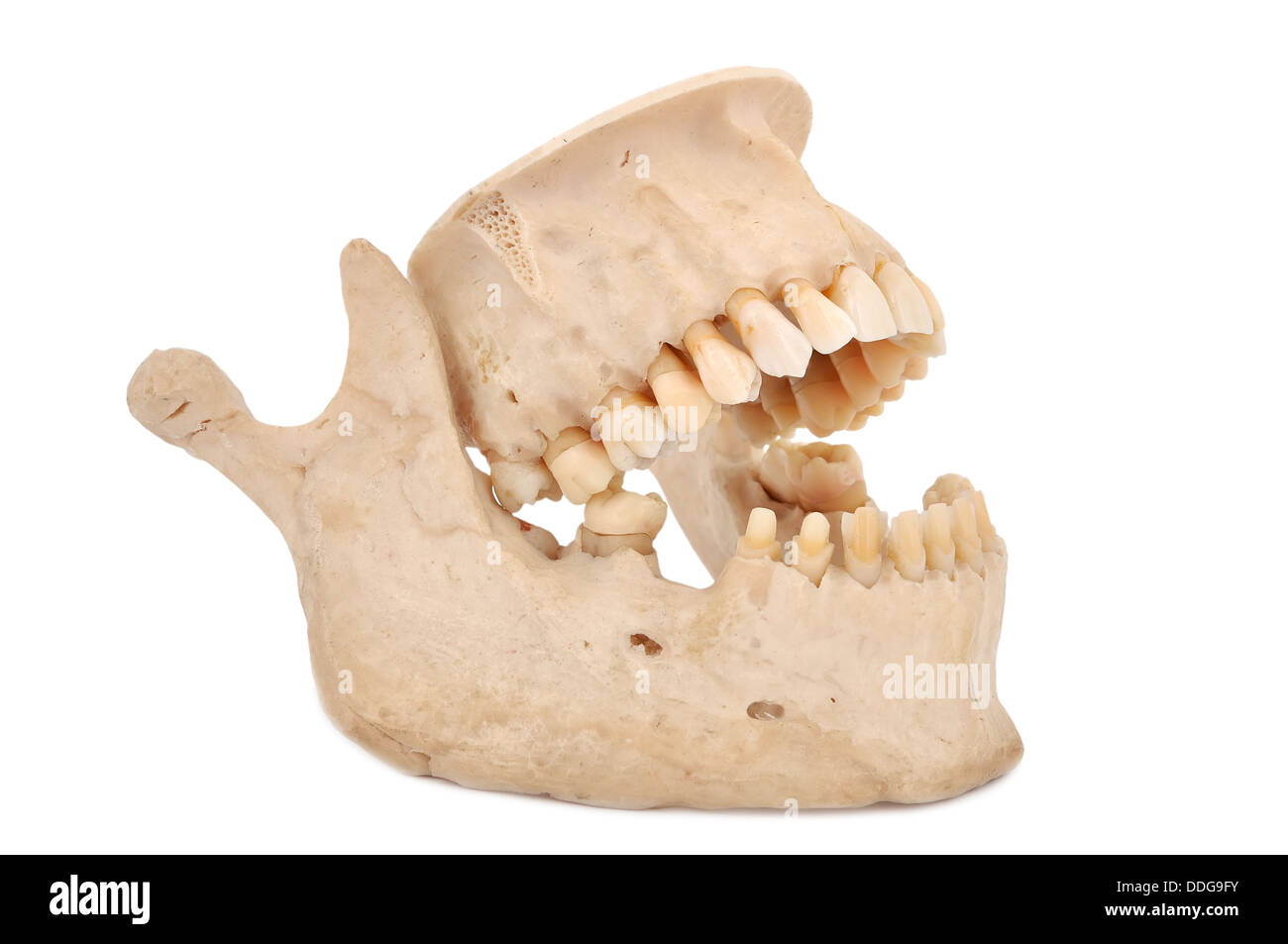 Human jaw bone hi-res stock photography and images - Alamy