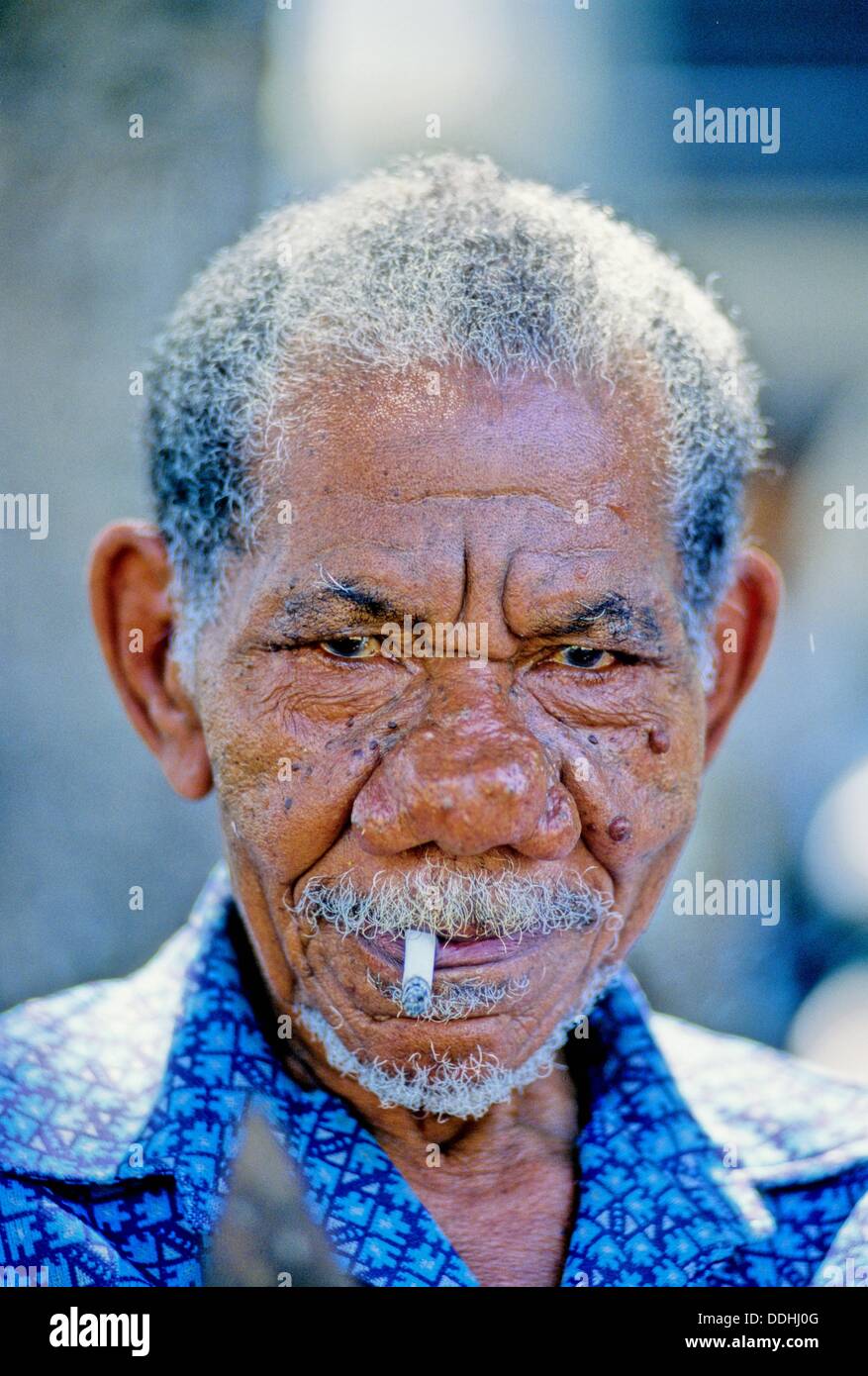 Disfigured man hi-res stock photography and images - Alamy