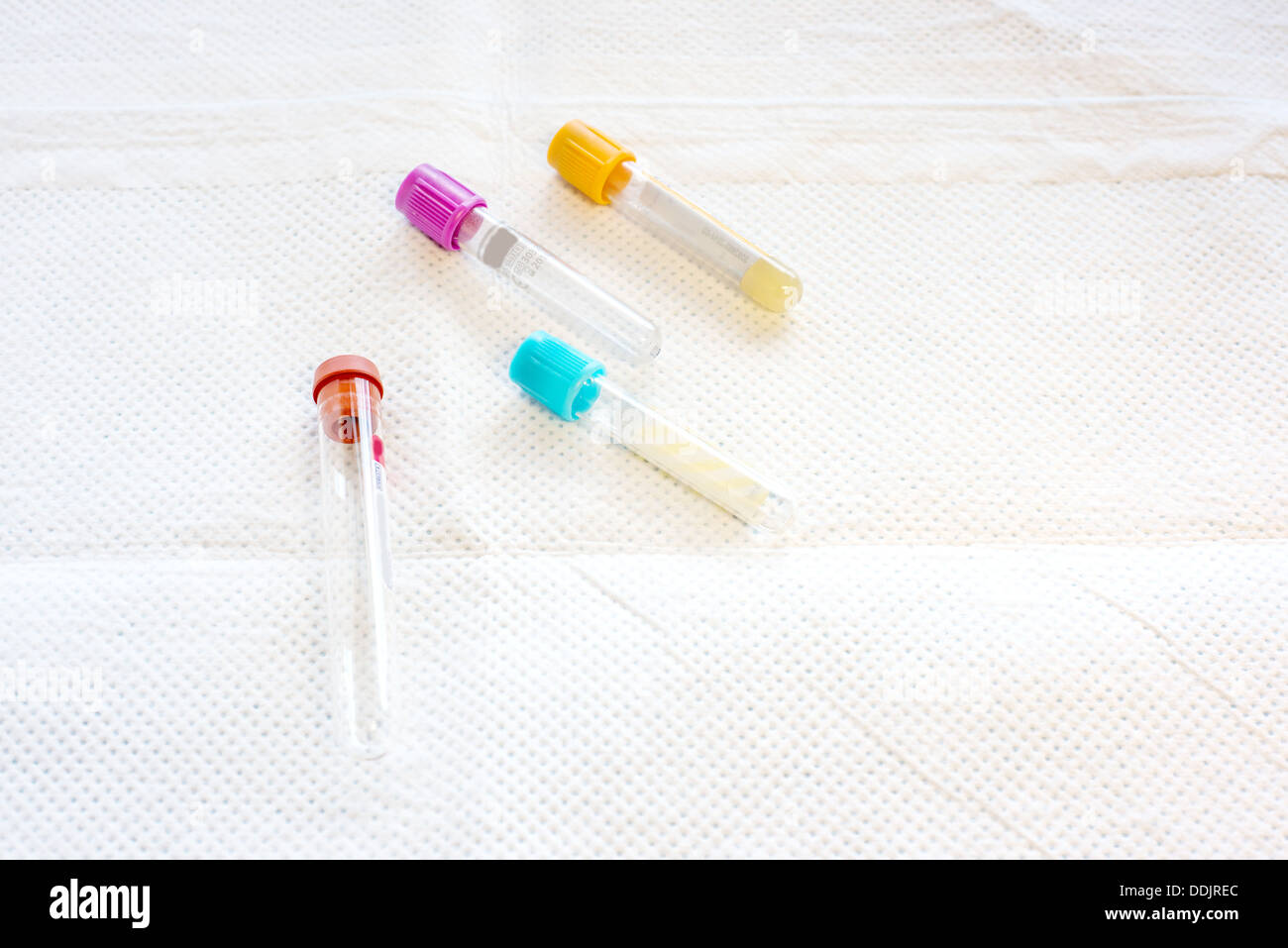 Tubes with blood hi-res stock photography and images - Alamy