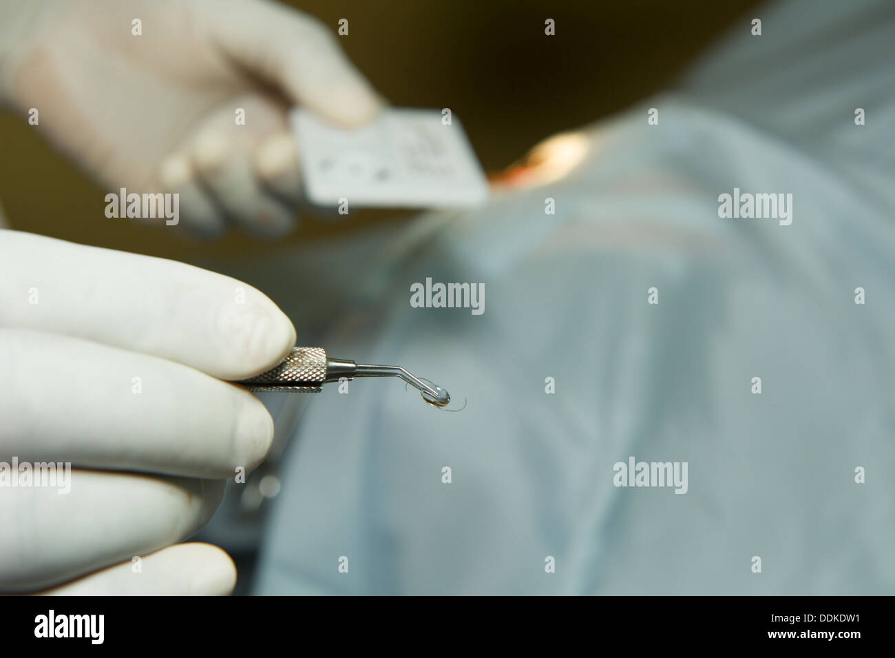 An ophthalmologist practices cataract surgery in mobile clinic Stock ...