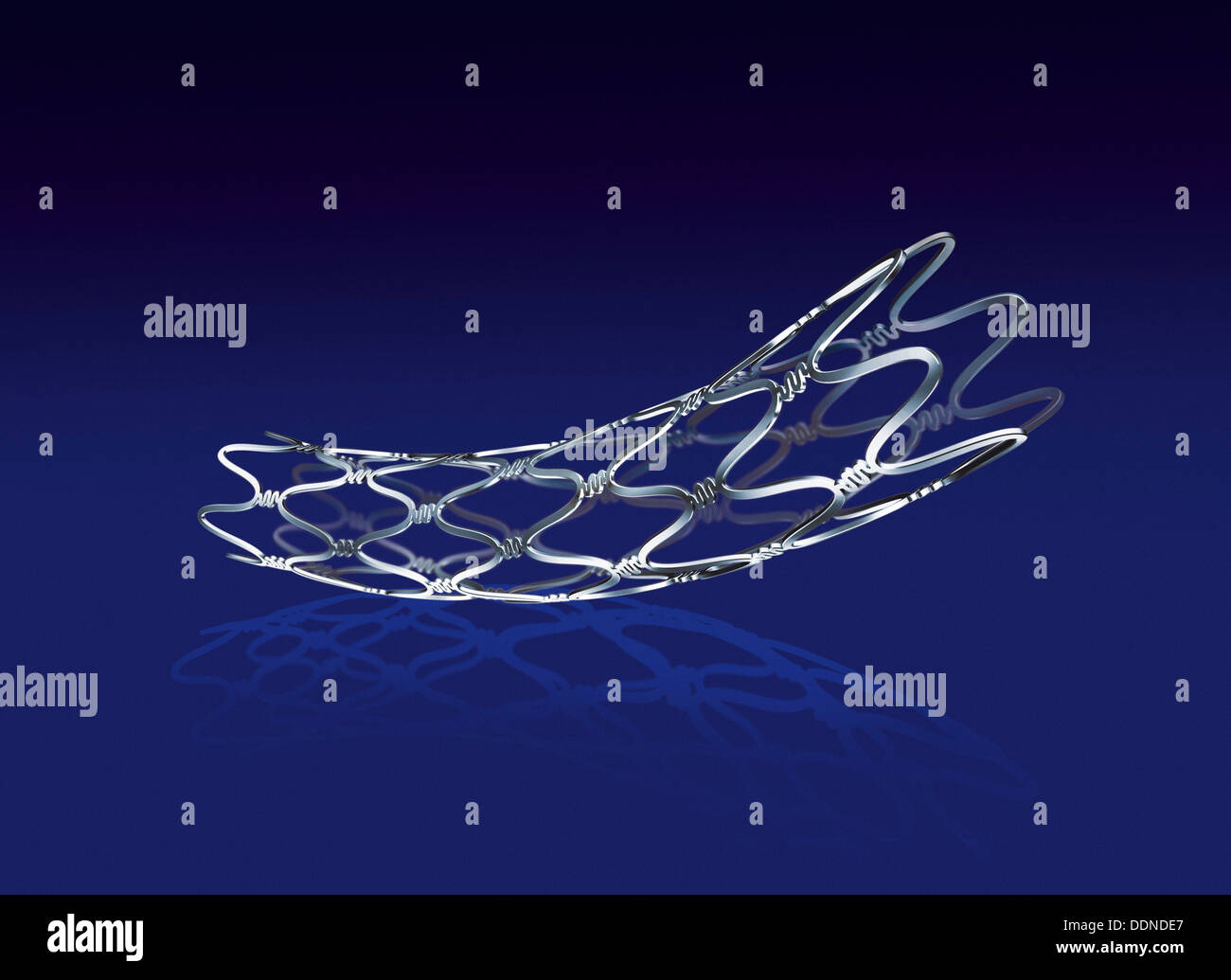 Stent Illustration High Resolution Stock Photography and Images - Alamy