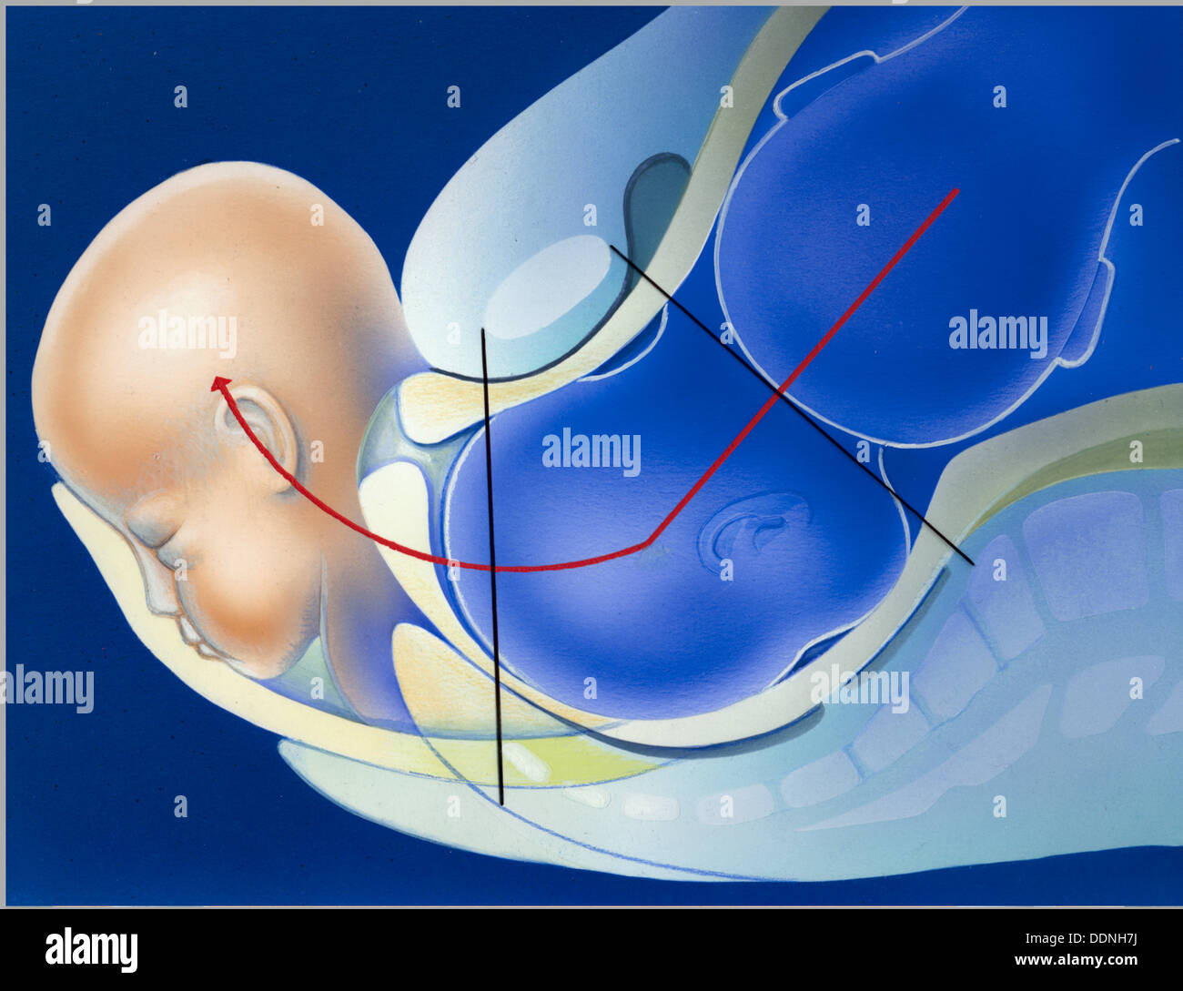 Prenatal give birth hi-res stock photography and images - Alamy