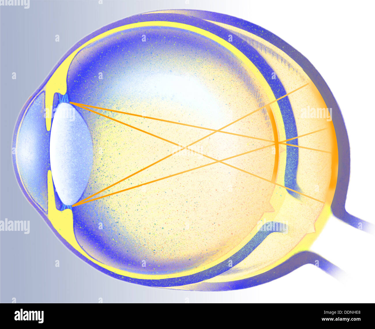 Nearsighted hi-res stock photography and images - Alamy