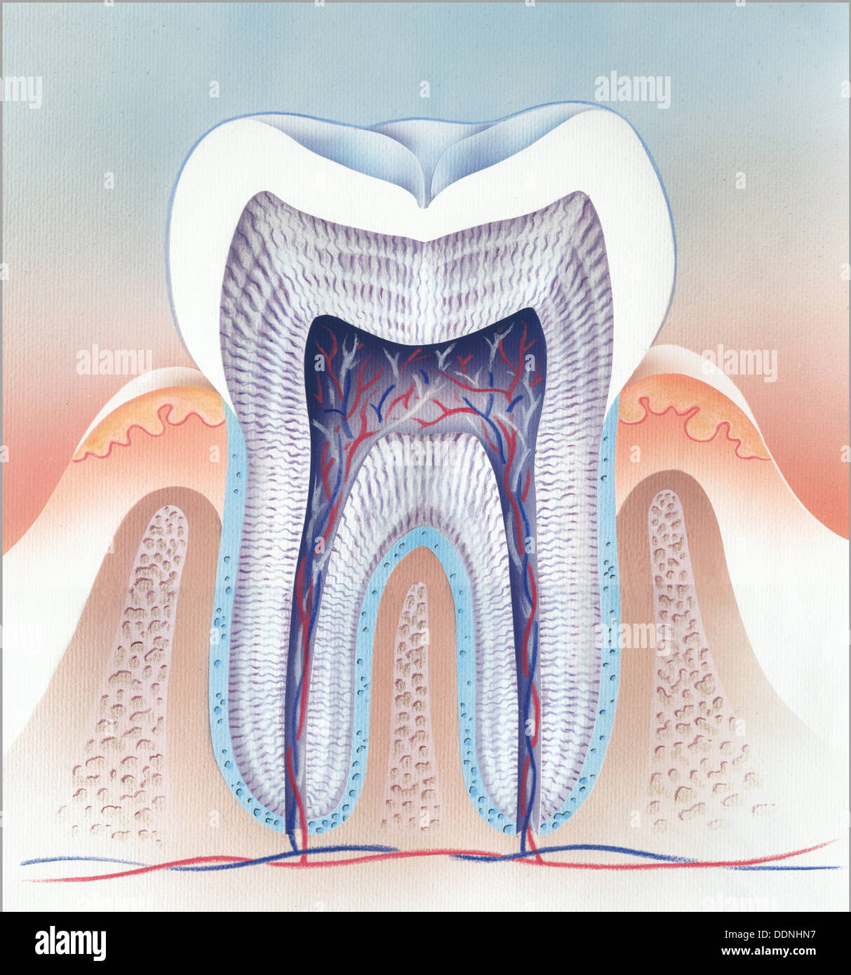 Human tooth with Periodontitis Stock Photo - Alamy