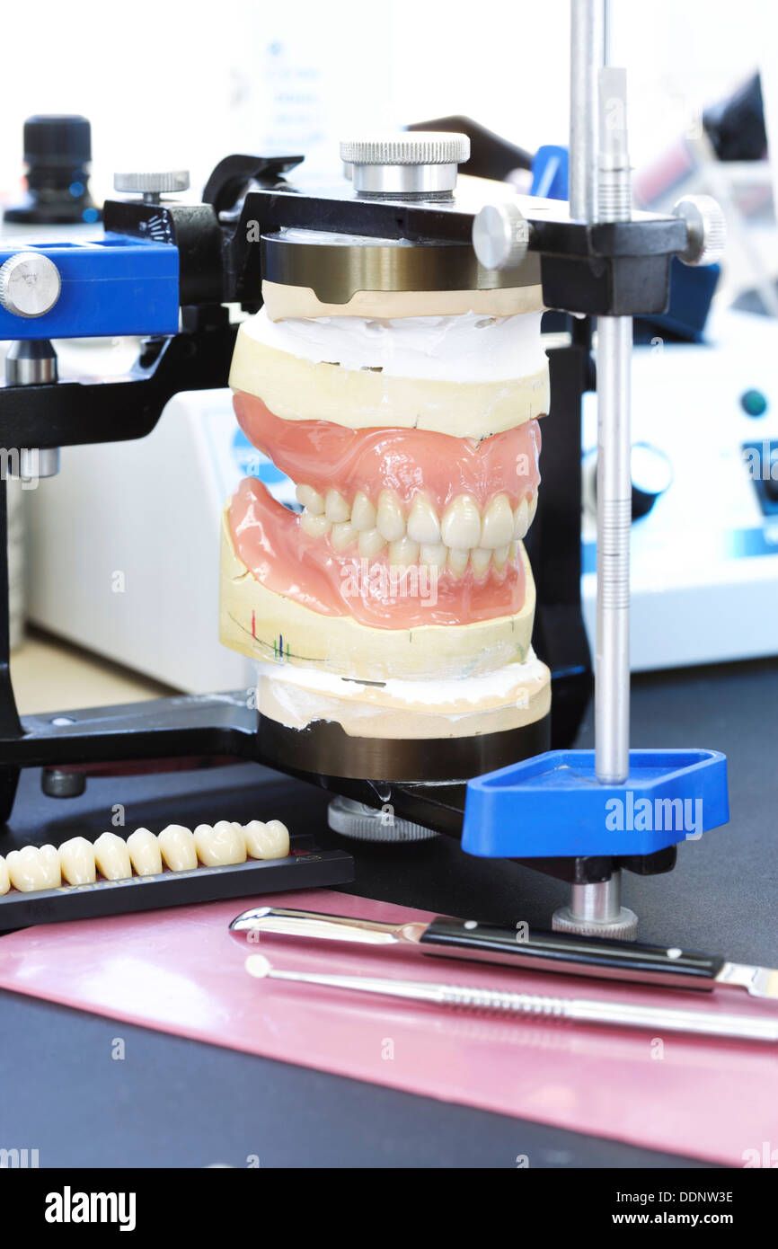 Articulator with plaster model and complete denture prosthesis made ...