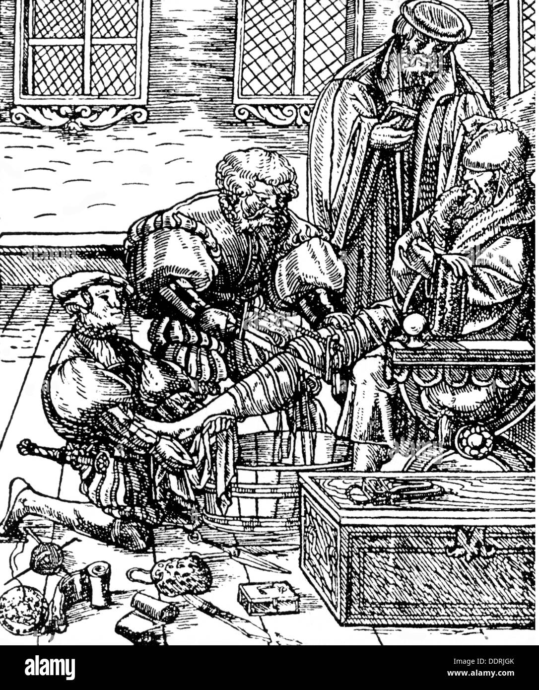 medicine, surgery, amputation, leg amputation with a bone saw Stock ...