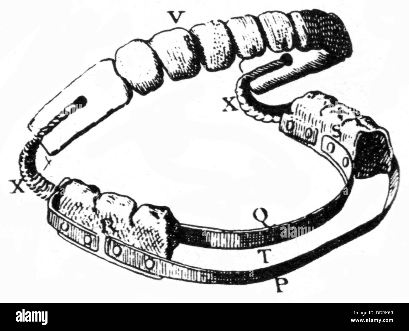 Full set of false teeth Cut Out Stock Images & Pictures - Alamy