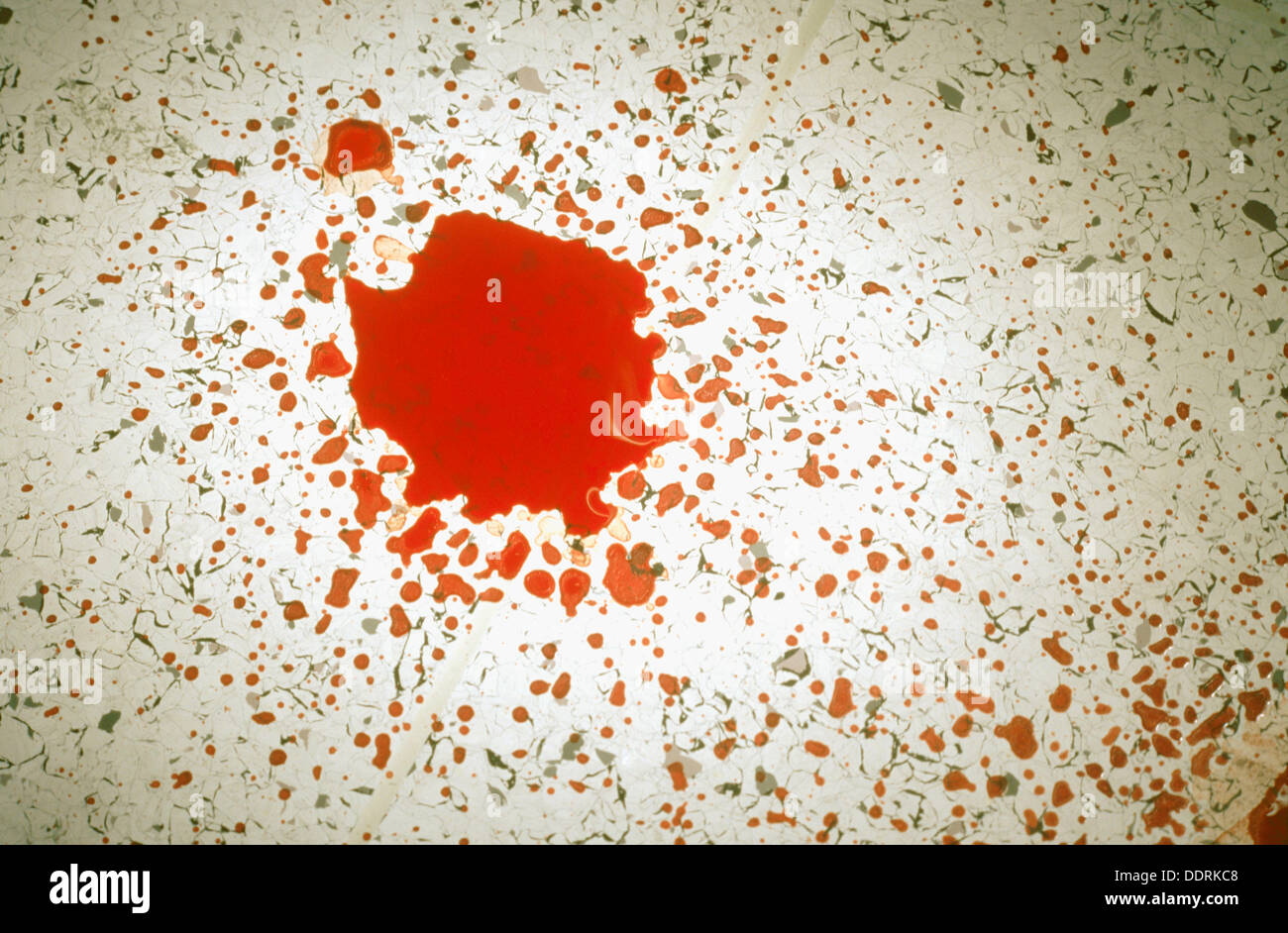 Negative stain hi-res stock photography and images - Alamy