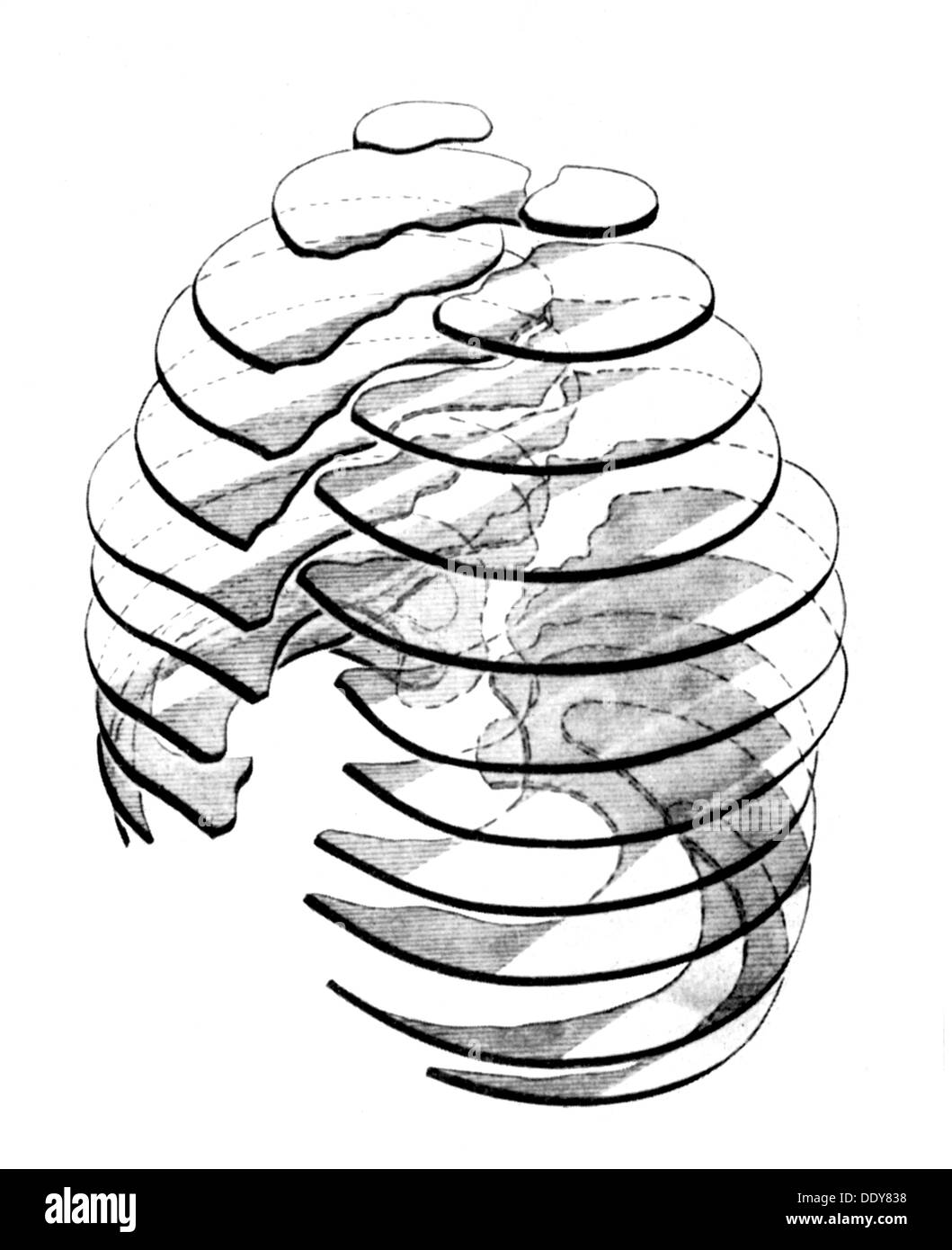 medicine, irradiation / X-ray / measurement, transversal tomography ...
