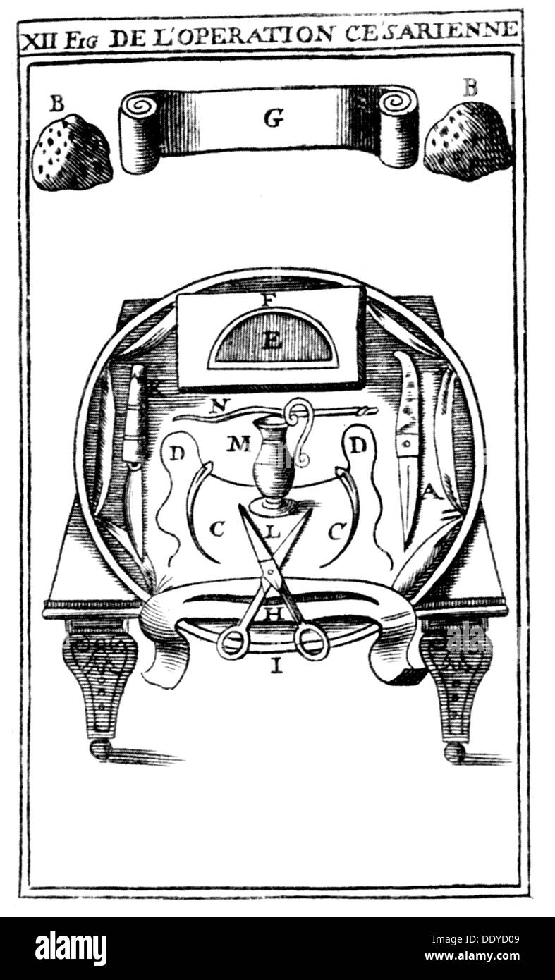 medicine, birth / gynecology, instruments for the Caesarean, woodcut ...