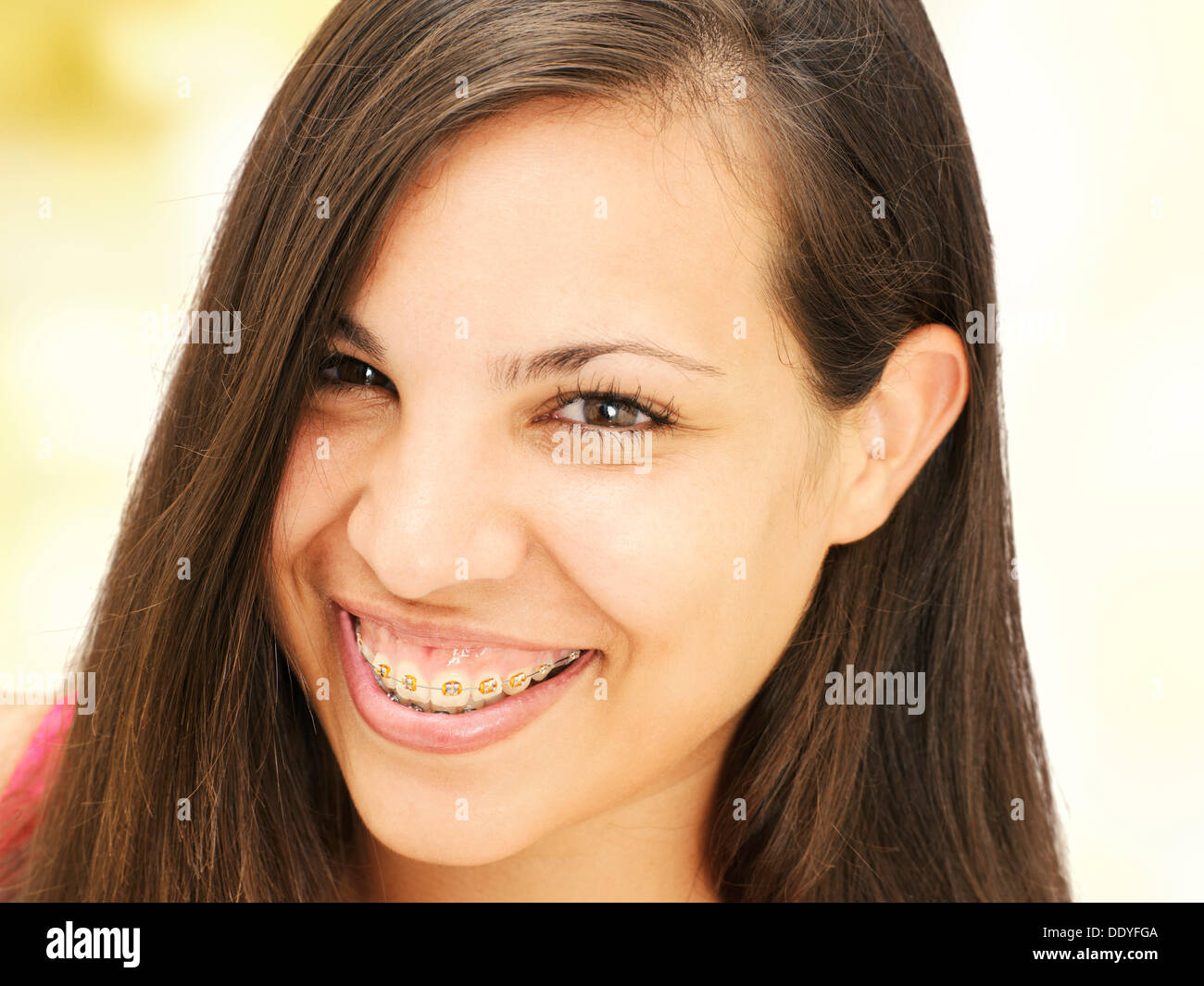 Smiling young Indian woman wearing orange braces Stock Photo - Alamy Smiling young Indian woman wearing orange braces Stock Photo - Alamy
