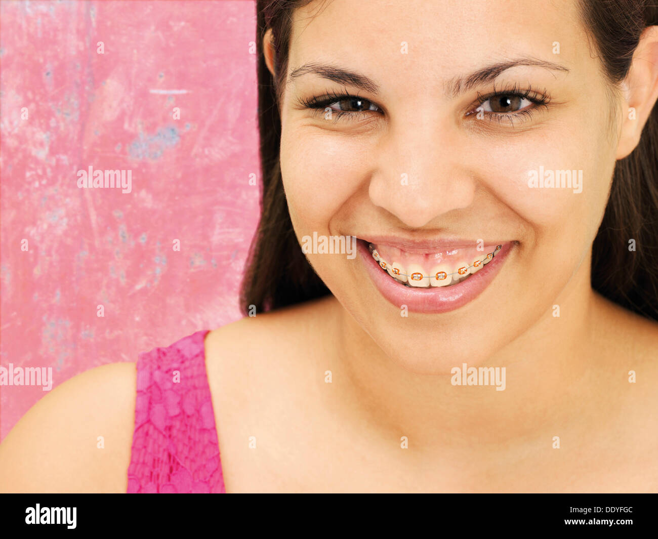 Smiling young Indian woman wearing orange braces Stock Photo - Alamy Smiling young Indian woman wearing orange braces Stock Photo - Alamy