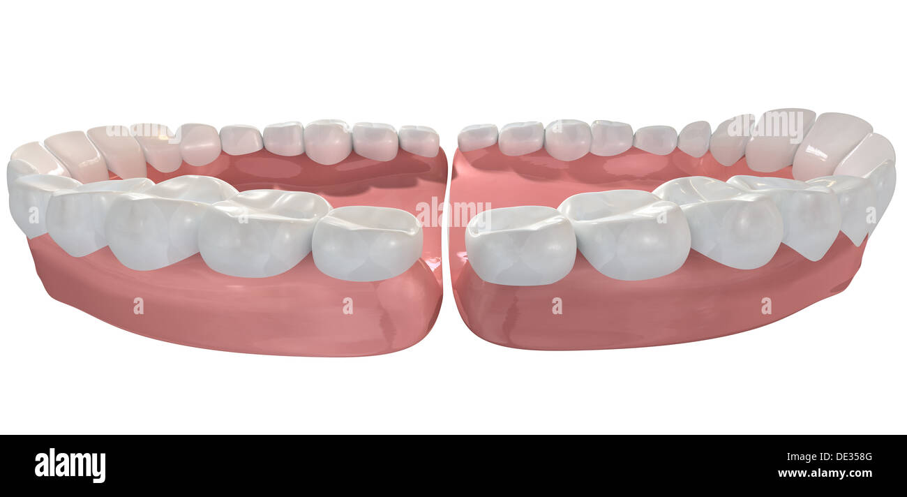 An extreme closeup of a set of open false human teeth set in pink gums ...