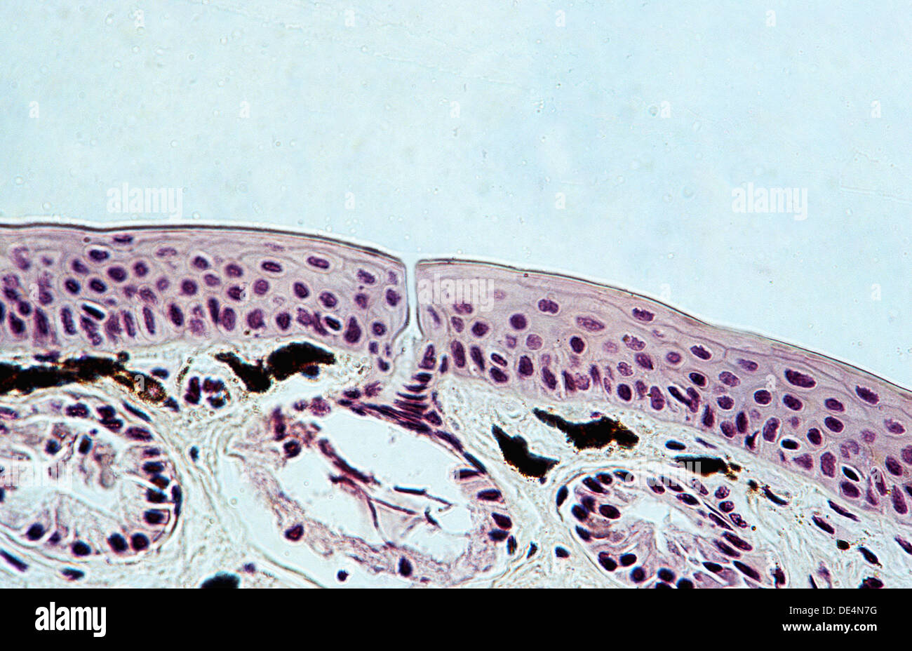 Skin Histology Stock Photos & Skin Histology Stock Images - Alamy