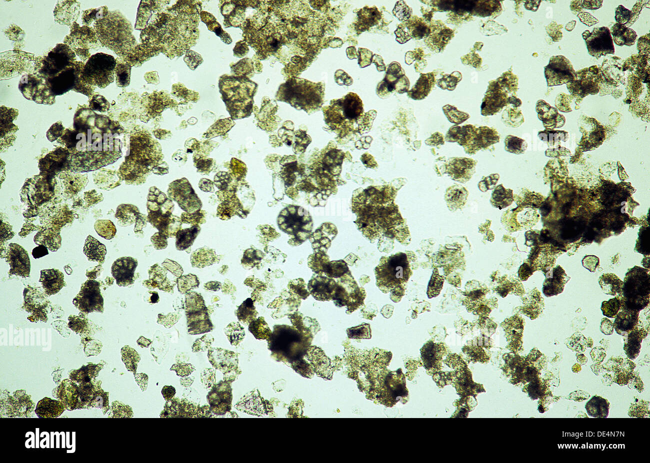Foram Between Sand Foraminifera 100 X Protozoa Optical