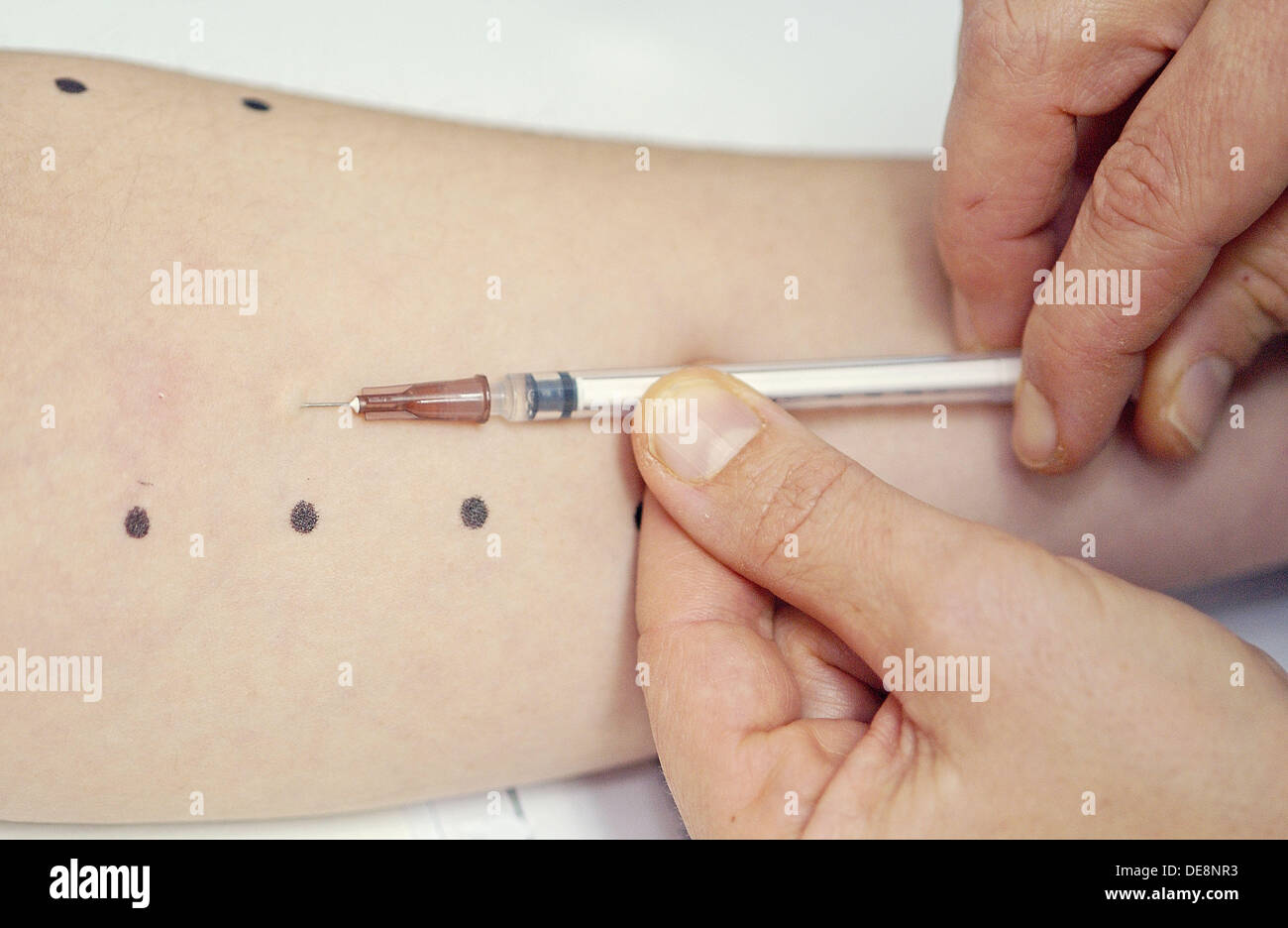 Allergy testing hi-res stock photography and images - Alamy