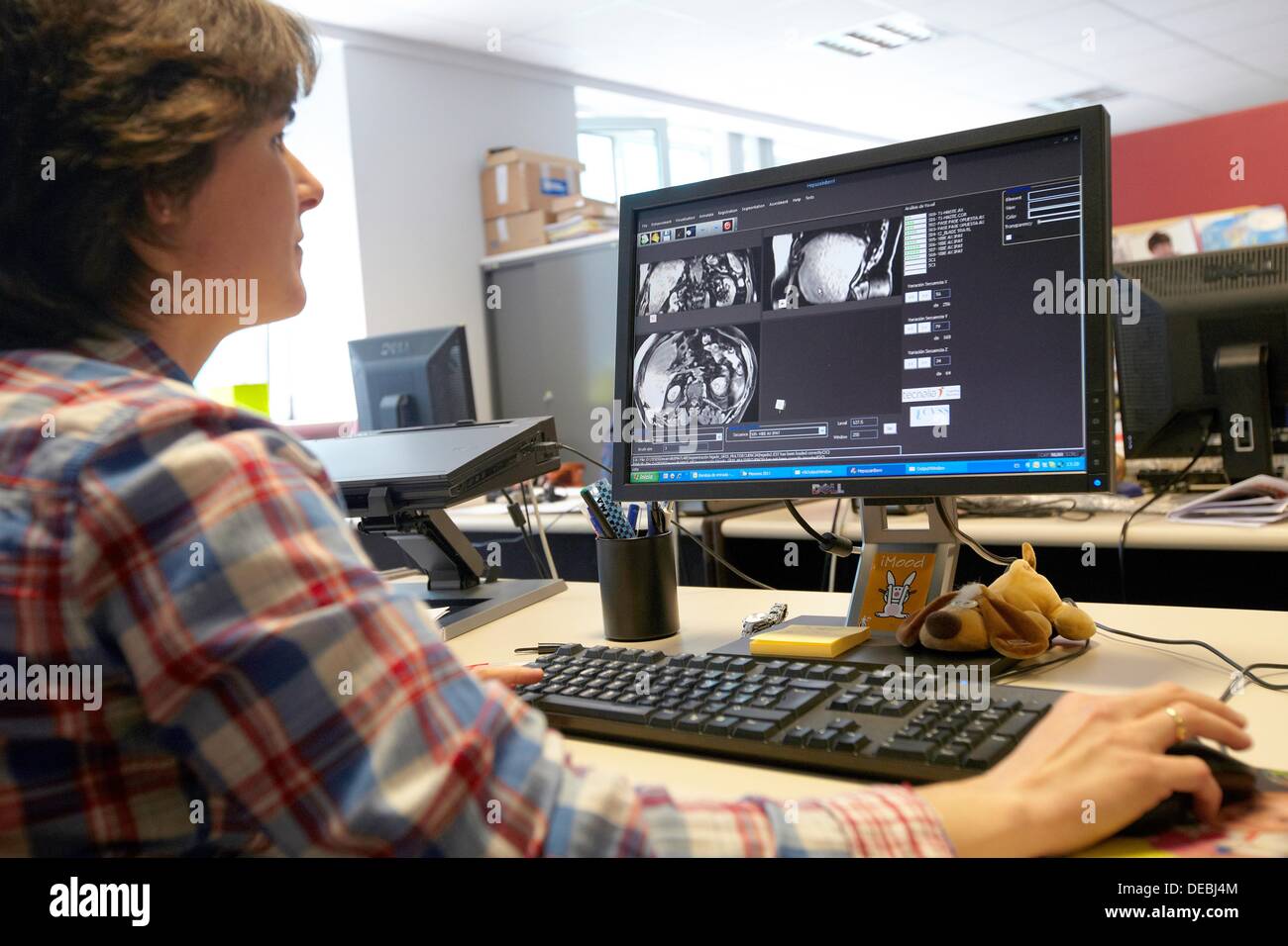 Medical images such as MRI processing techniques, Segmentation ...