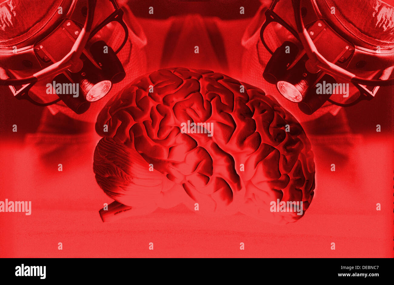 Brains Surgery High Resolution Stock Photography and Images - Alamy