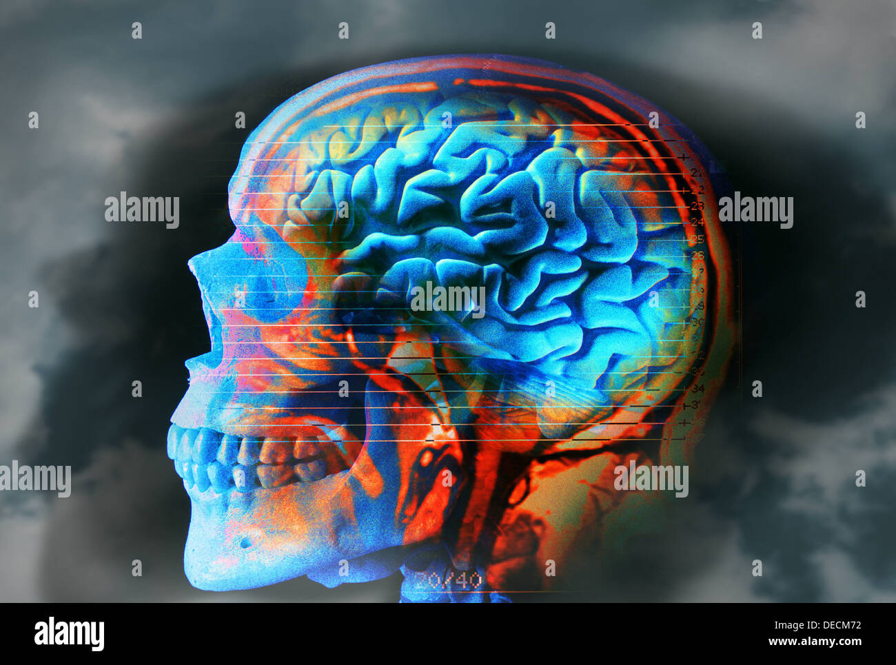 Human Brain Montage High Resolution Stock Photography and Images - Alamy