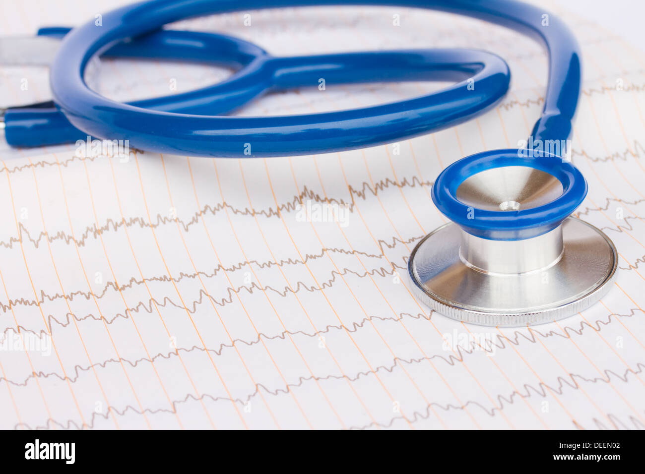 Stethoscope on ECG Stock Photo - Alamy
