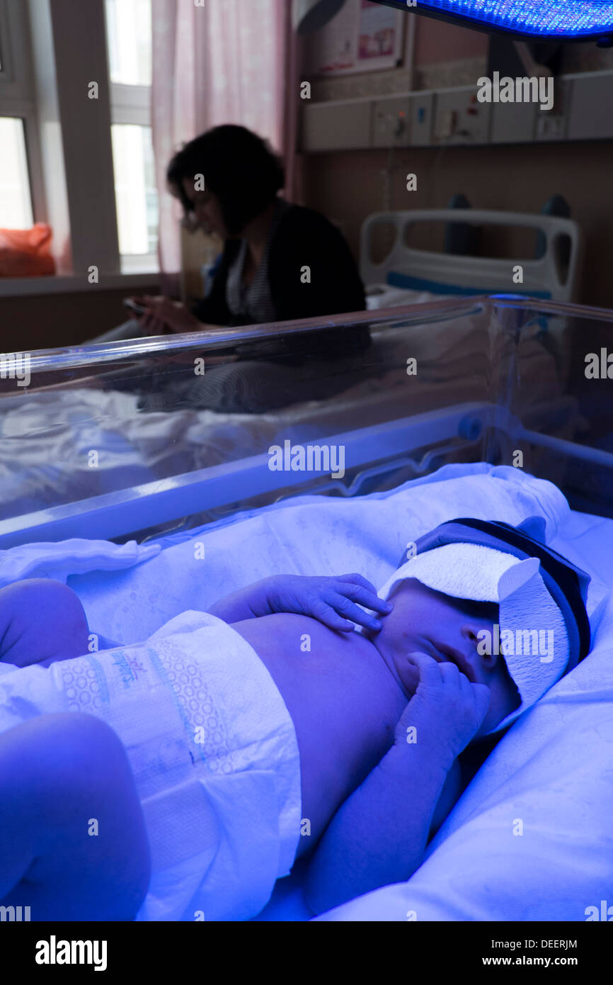 A newborn baby boy getting treated for jaundice under a phototherapy ...