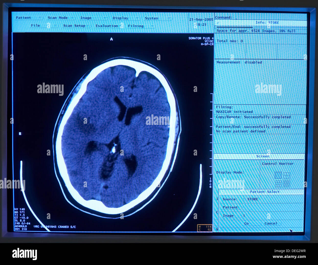 CAT (Computerized Axial Tomography), medical imaging for diagnosis ...