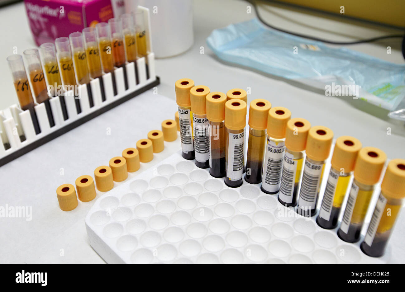 Blood samples for biobank hi-res stock photography and images - Alamy