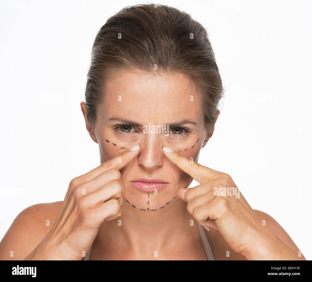 Woman with plastic surgery marks on face pointing on nose Stock Photo ...