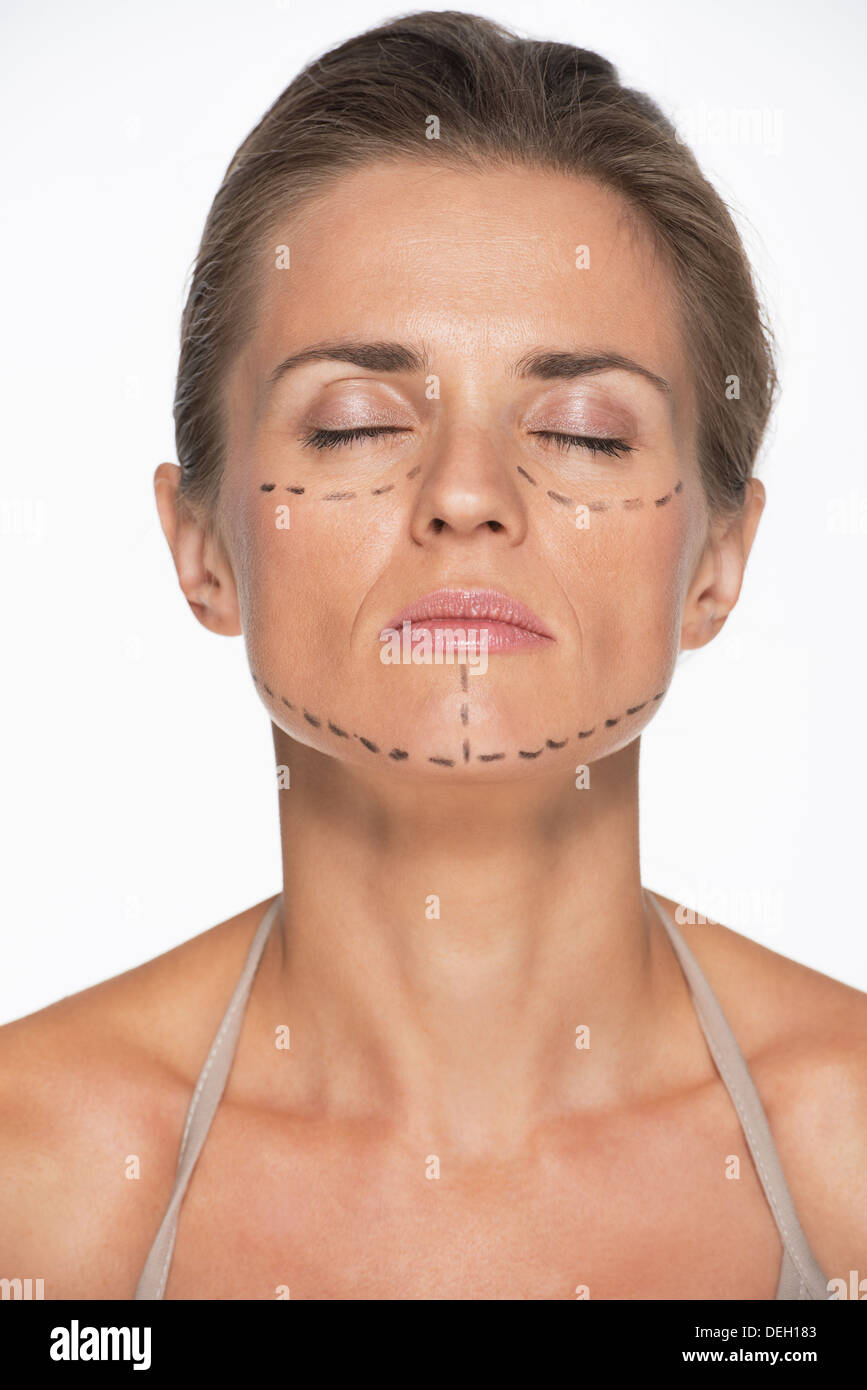 Woman plastic surgery marks hi-res stock photography and images - Alamy