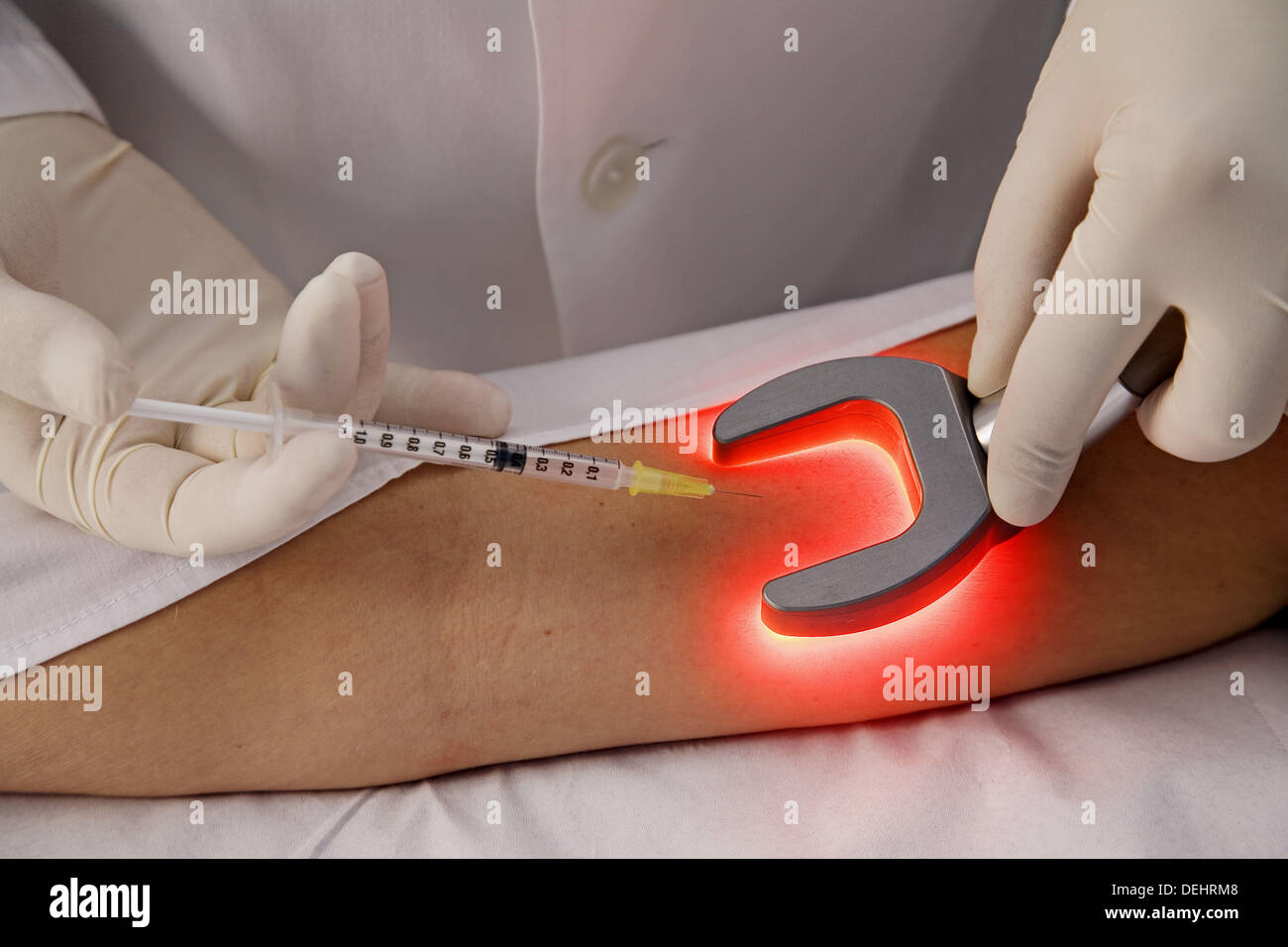 Varicose vein injection hi-res stock photography and images - Alamy