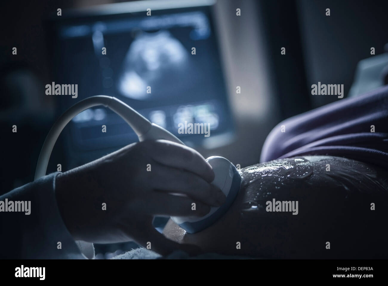 Medical sonogram hi-res stock photography and images - Alamy