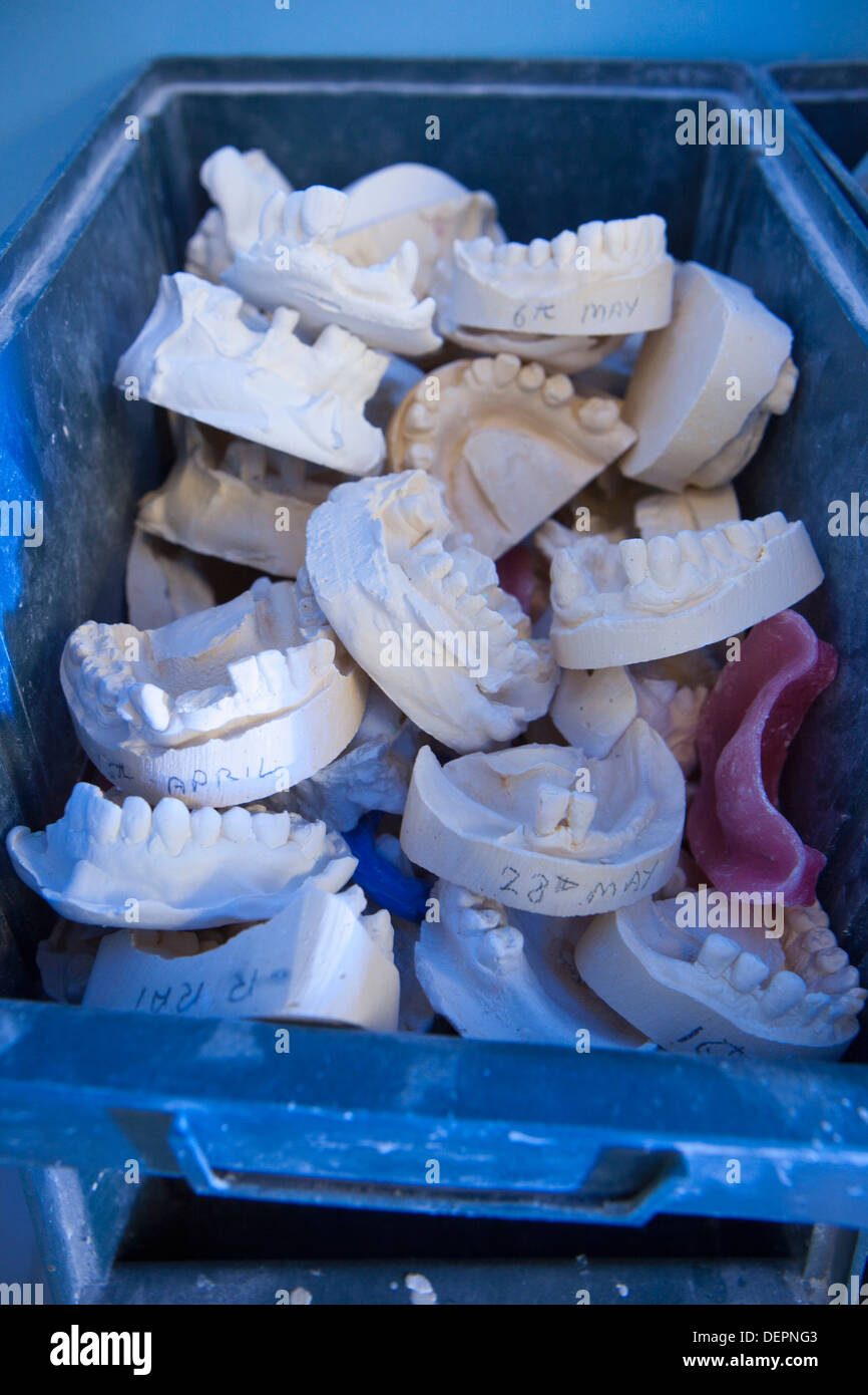 Plaster Teeth Molds in blue box Stock Photo - Alamy