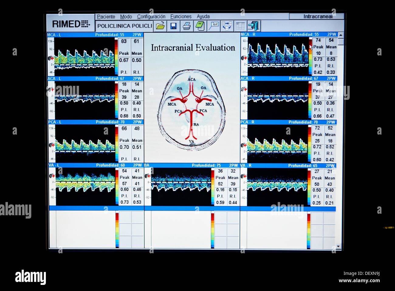 Transcranial High Resolution Stock Photography and Images - Alamy