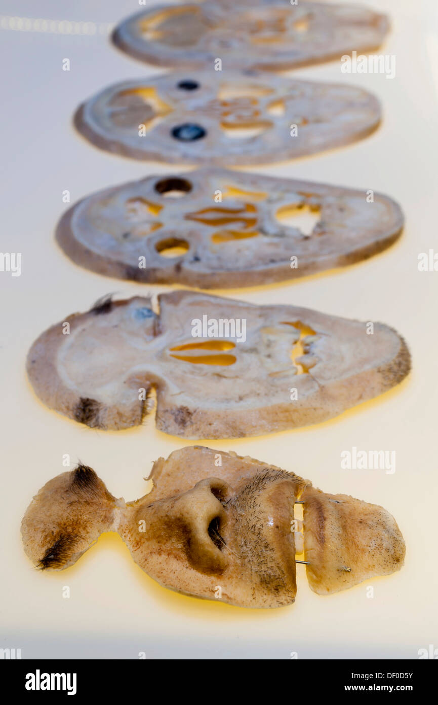 Plastination slice head hi-res stock photography and images - Alamy