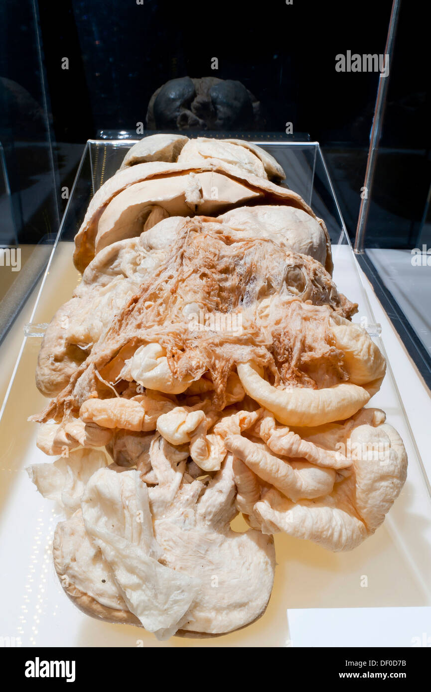 Plastination specimen of human abdominal and thoracic organs Stock ...