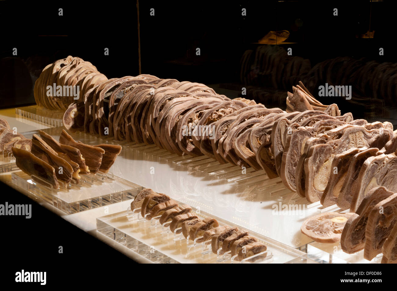 Plastination slice hi-res stock photography and images - Alamy