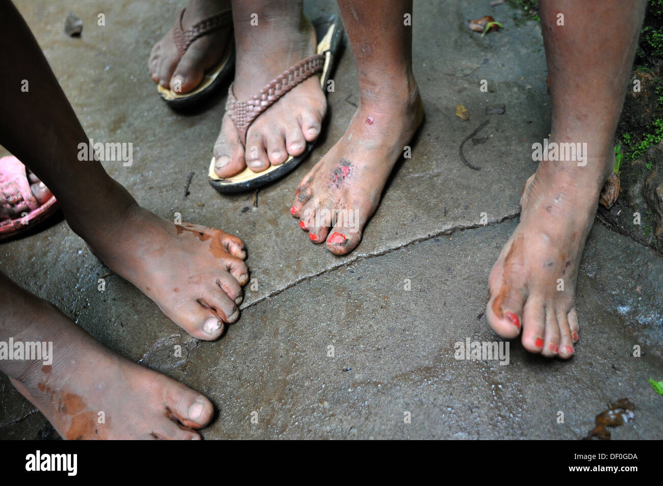 Lao children in poverty wear no shoes Stock Photo - Alamy