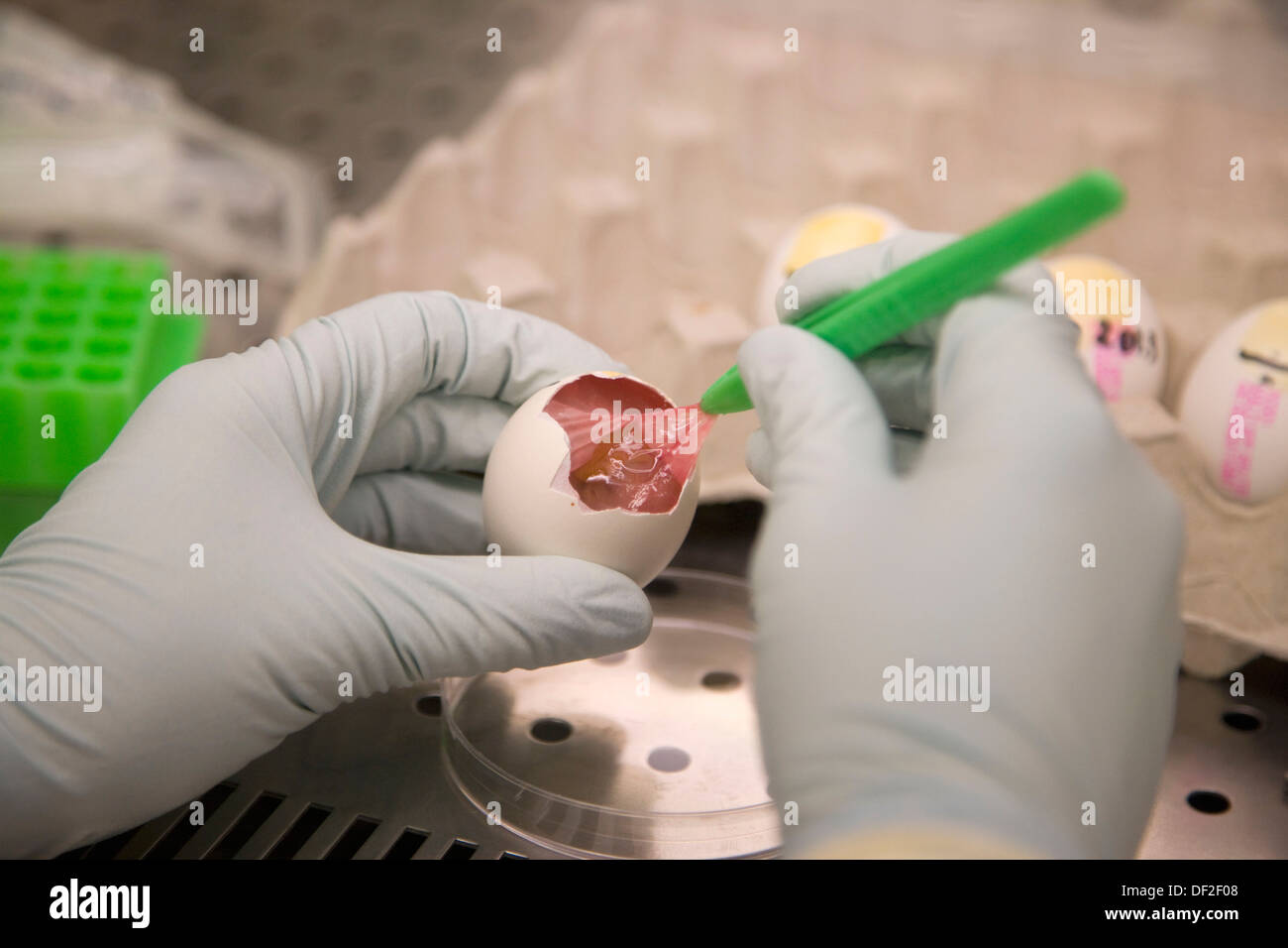 Human fluids hi-res stock photography and images - Alamy