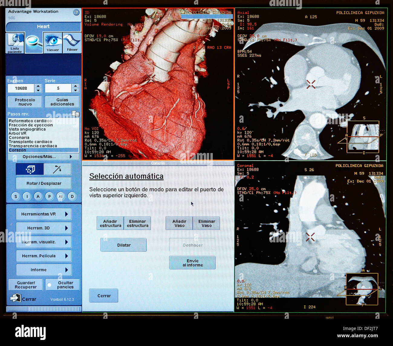 Hd scan hi-res stock photography and images - Alamy