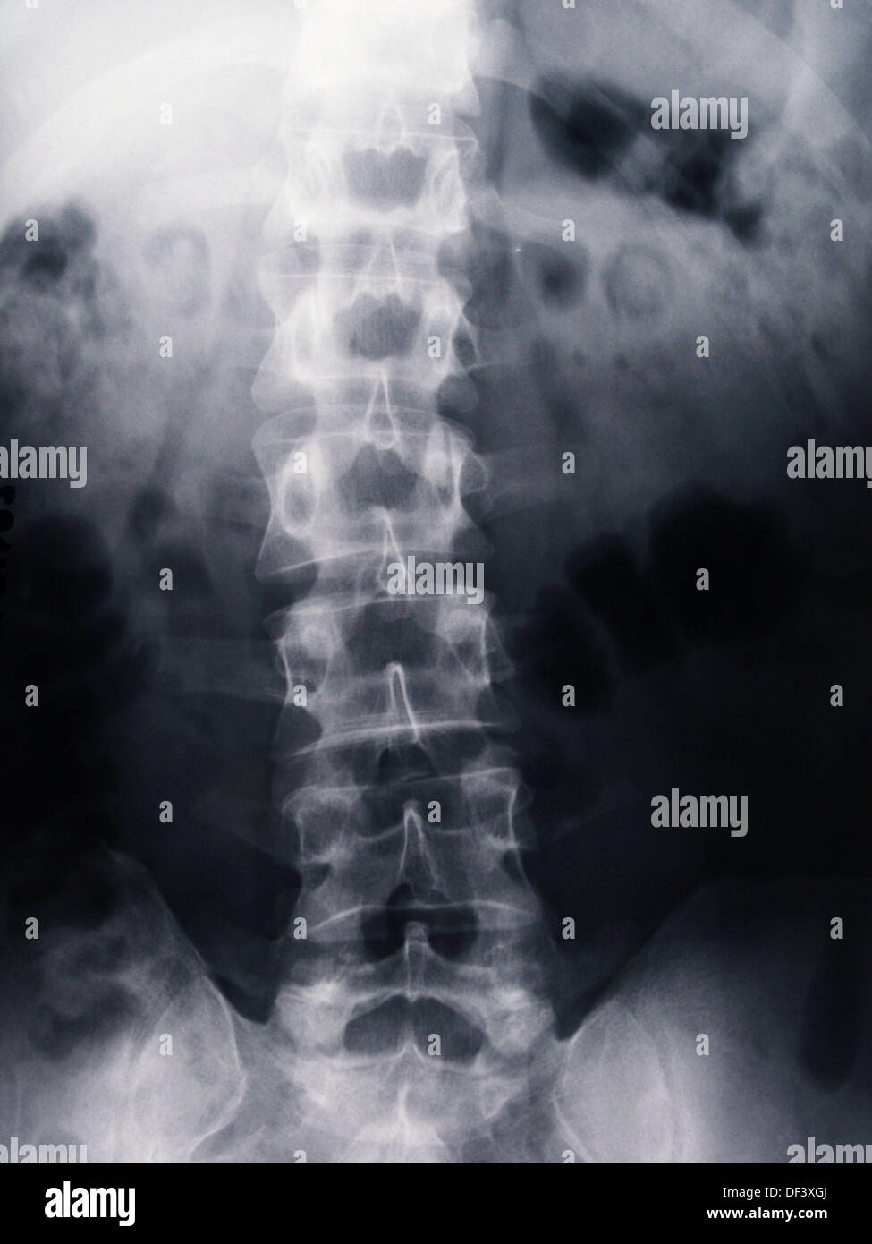 Human being skeleton hi-res stock photography and images - Alamy