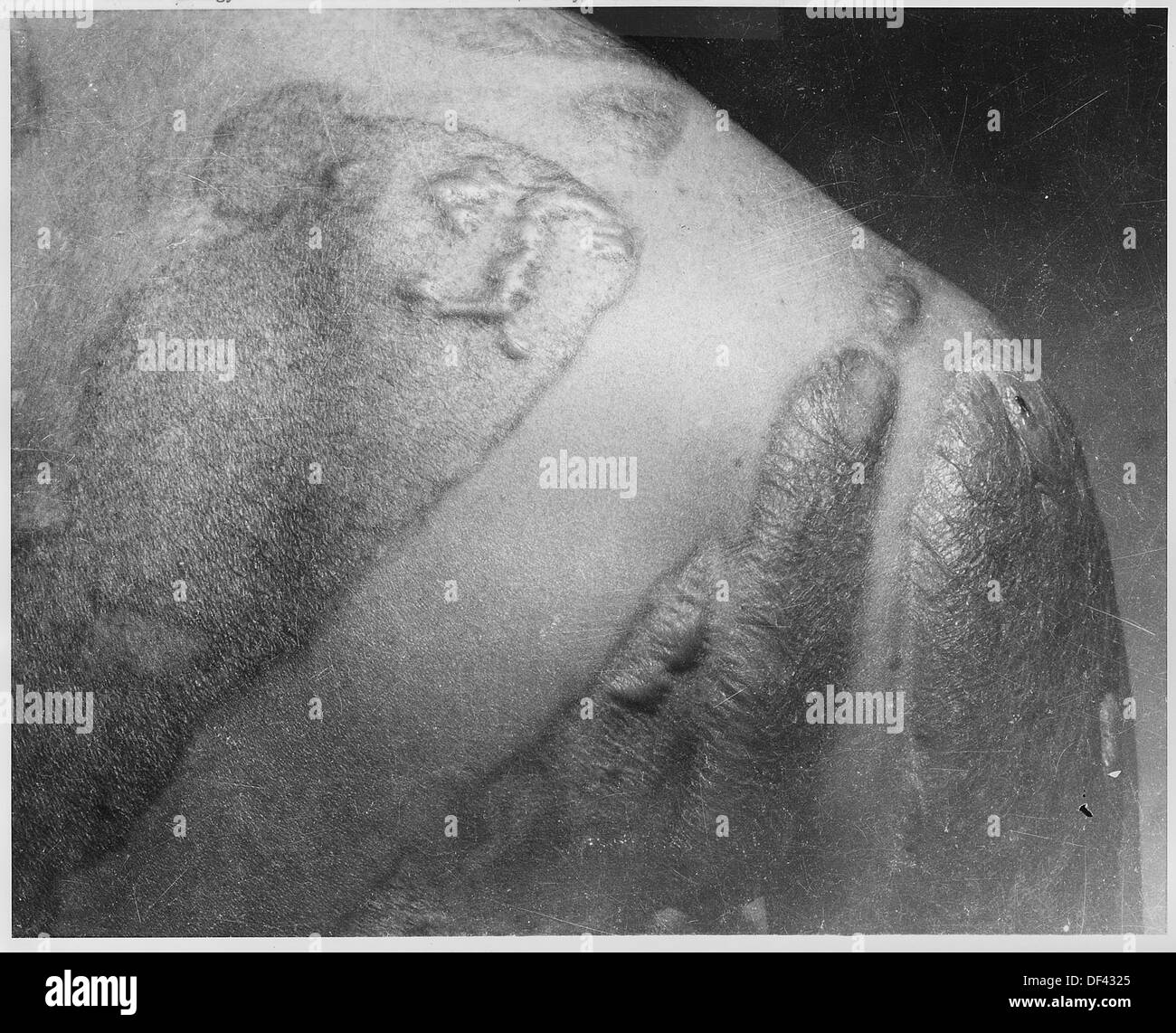 This image depicts the devastating effects of atomic heat and radiation ...