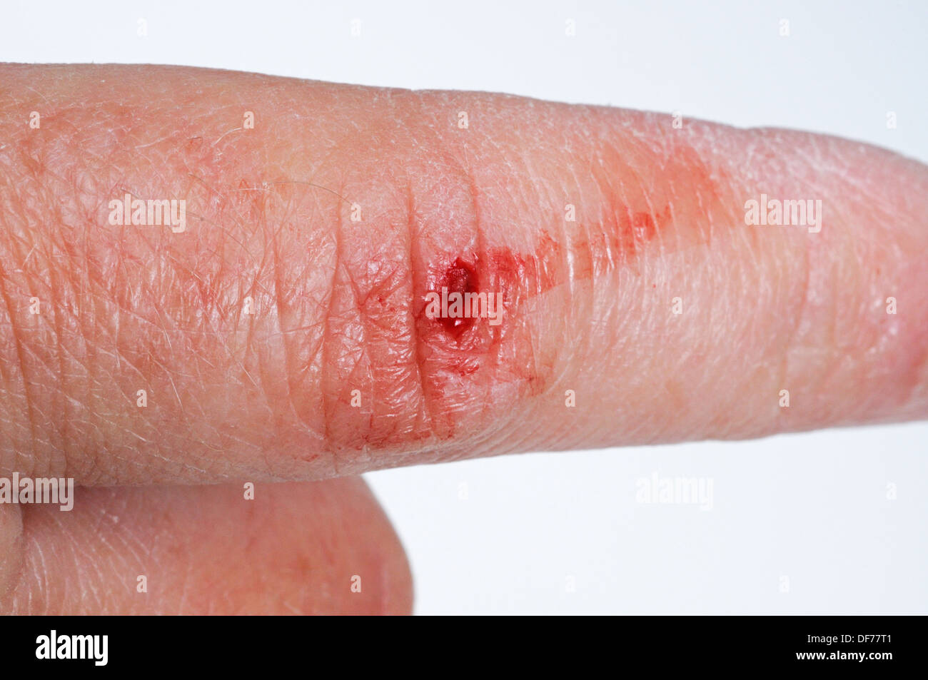 Human forefinger hi-res stock photography and images - Alamy