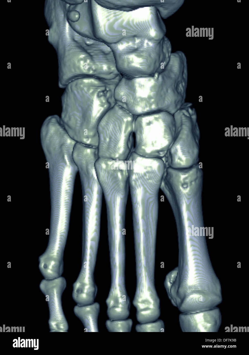 Cuboid bone hi-res stock photography and images - Alamy