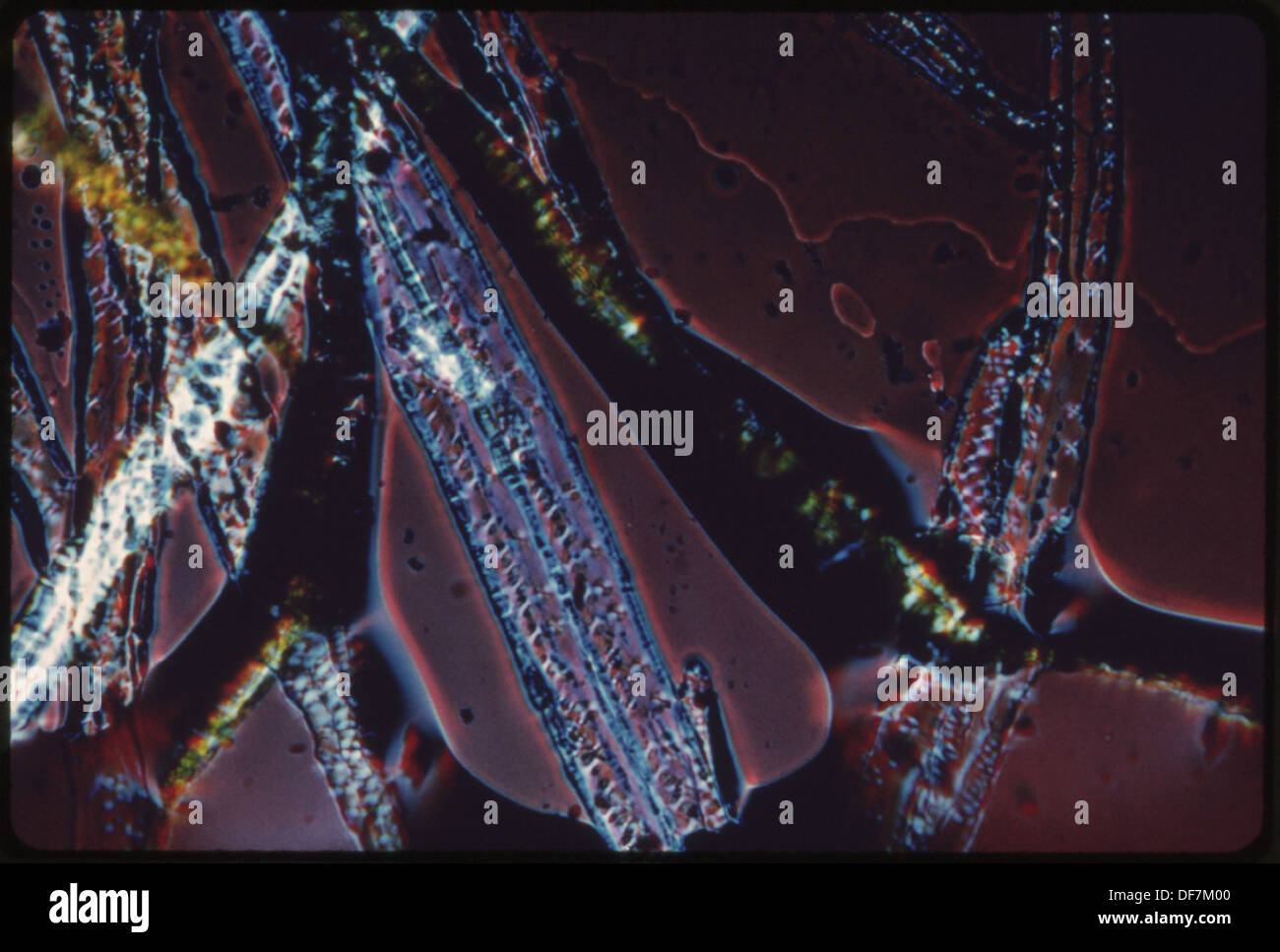 A phase contrast microphotograph of stained Douglas fir fibers, taken ...