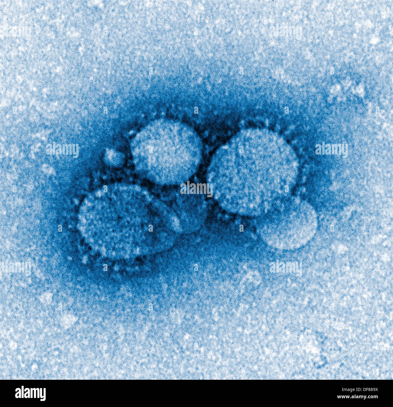 Mers virus hi-res stock photography and images - Alamy