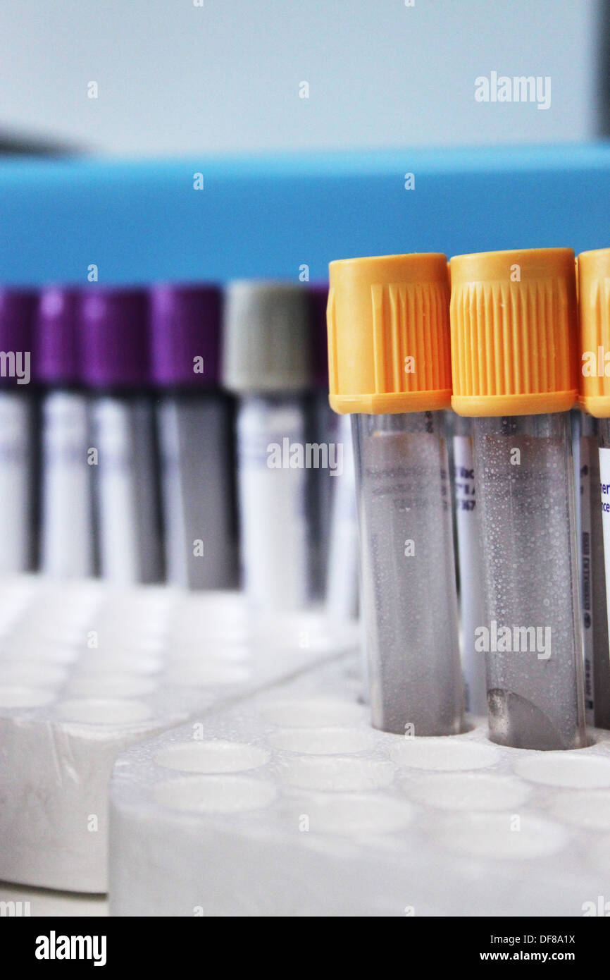 Laboratory material hi-res stock photography and images - Alamy