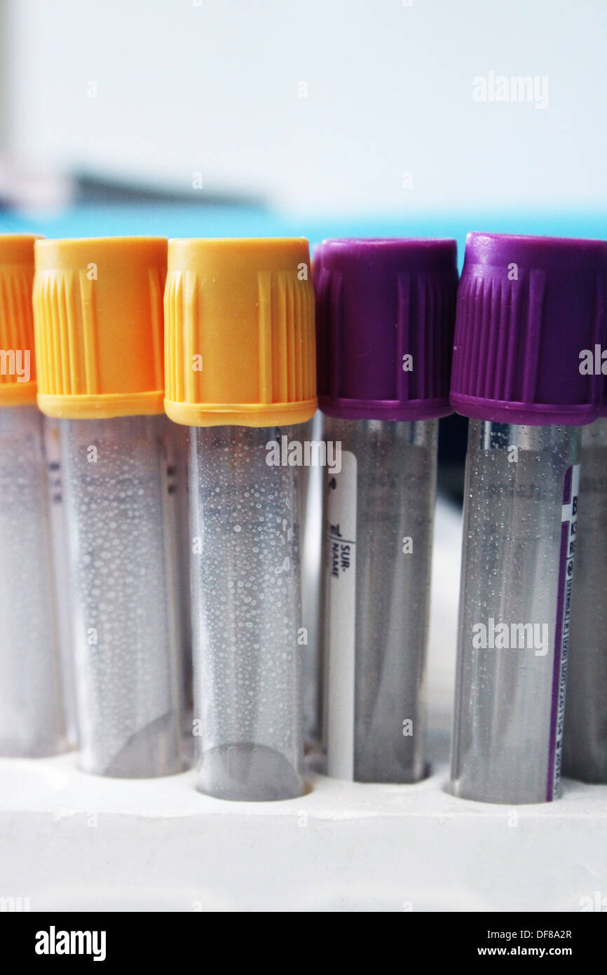 Laboratory material hi-res stock photography and images - Alamy