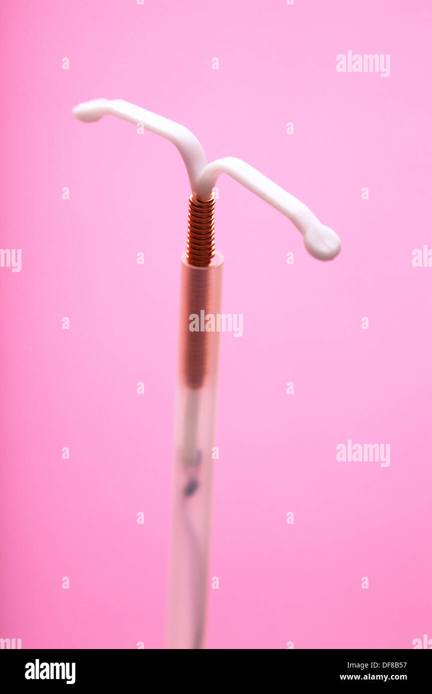 Iud Birth Control